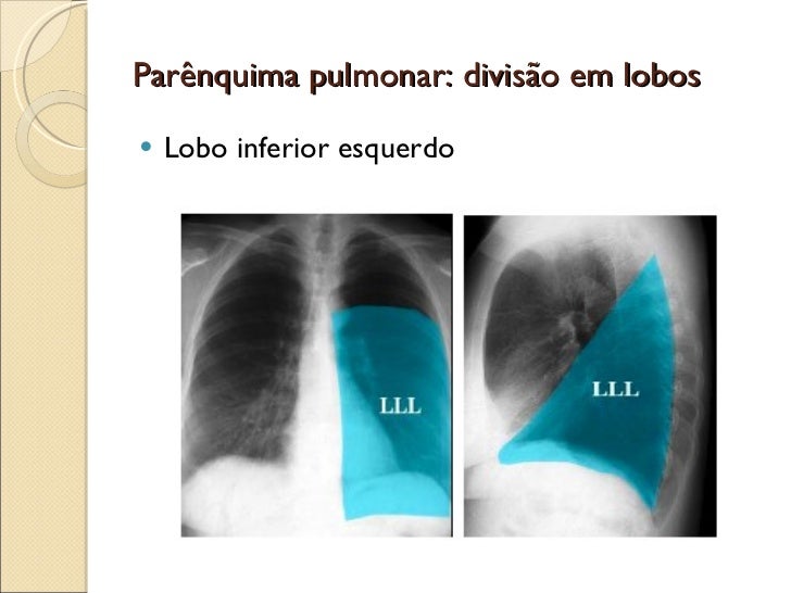 Radiografia normal do tórax