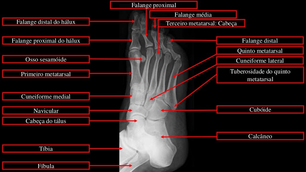 Radiografia oblíqua do pé