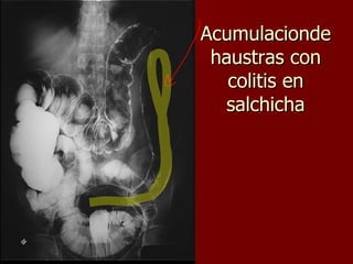 Radiografias De Colon | PPT