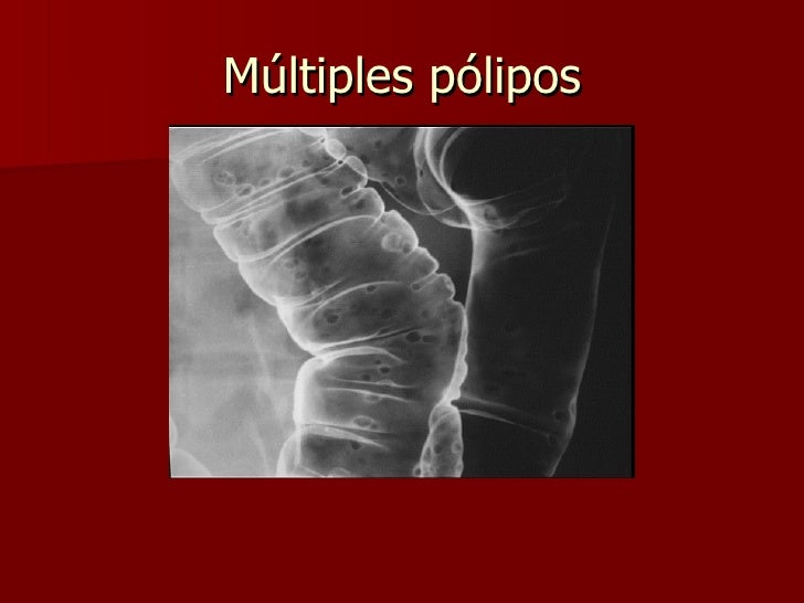 Radiografias De Colon