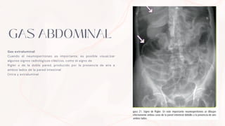 RADIOGRAFIA SIMPLE DE ABDOMEN Y SU INTERPRETACION | PDF