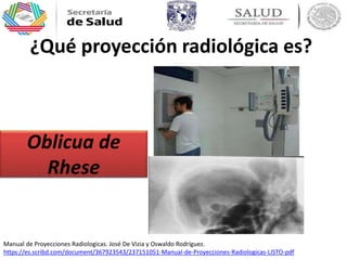 Radiografia spn y orbita | PPTX