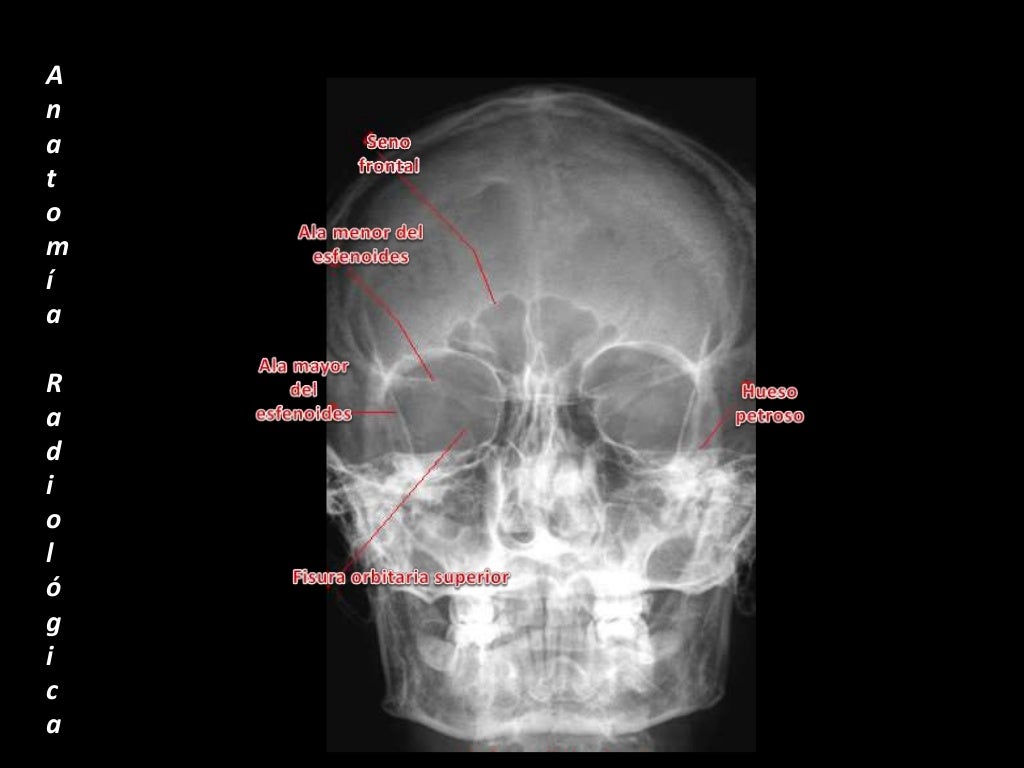Radiografia spn y orbita