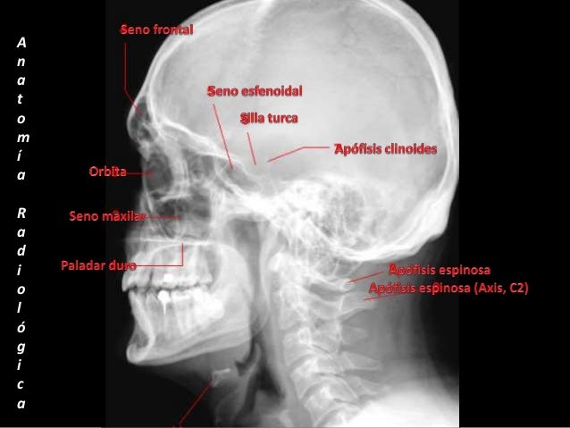 Radiografia spn y orbita