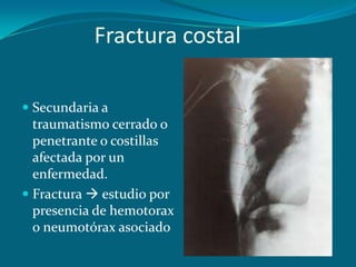 Radiografia de tórax, imágenes radiologicas y composición anatómica. | PDF