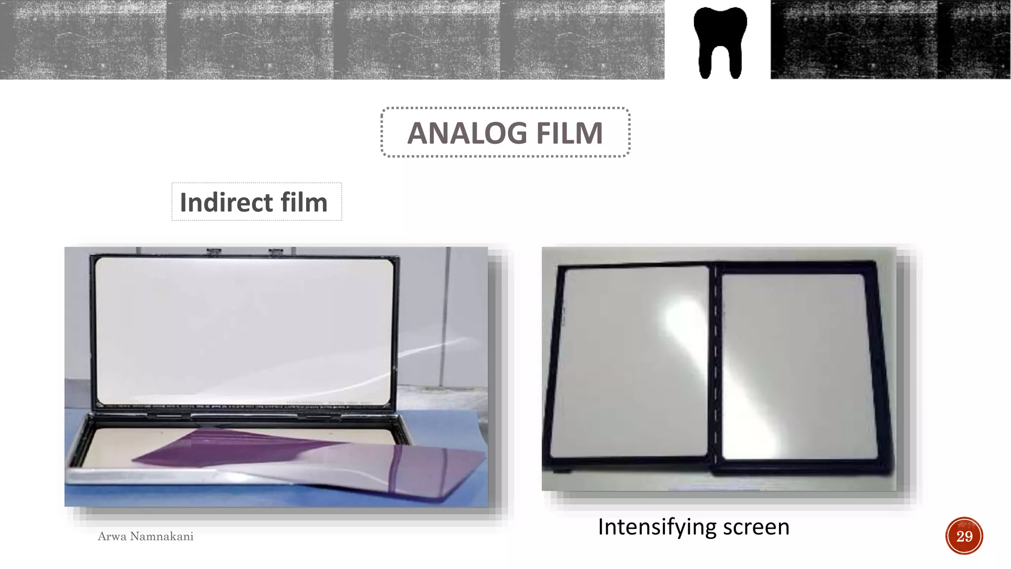Radiograph Techniques in Pediatric Dentistry | PPTX