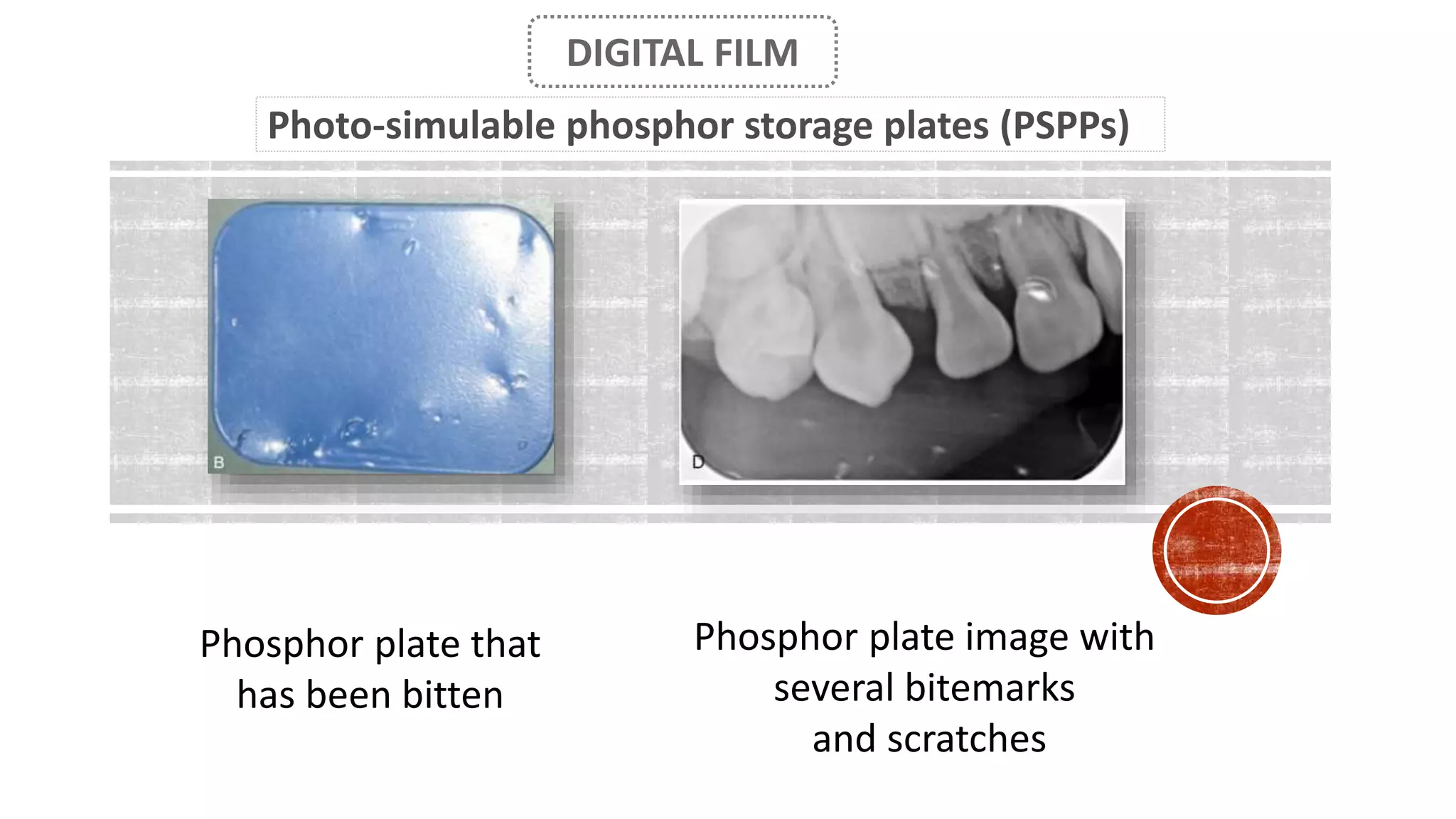 Radiograph Techniques in Pediatric Dentistry | PPTX