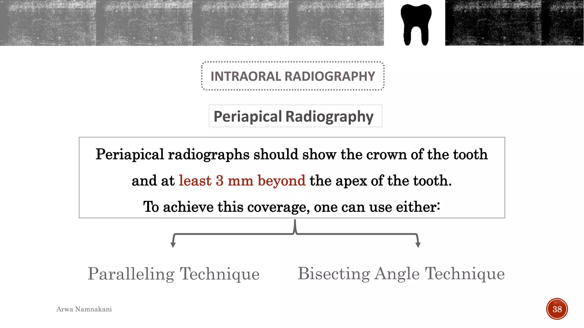 Radiograph Techniques in Pediatric Dentistry | PPTX