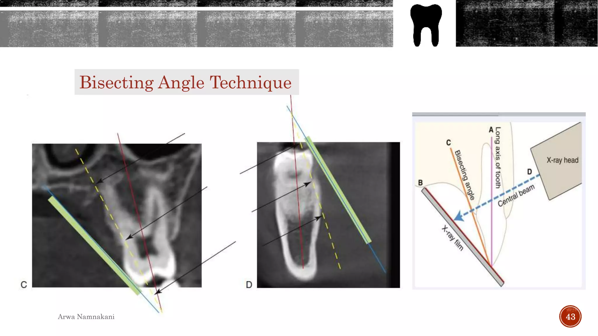 Radiograph Techniques in Pediatric Dentistry | PPTX