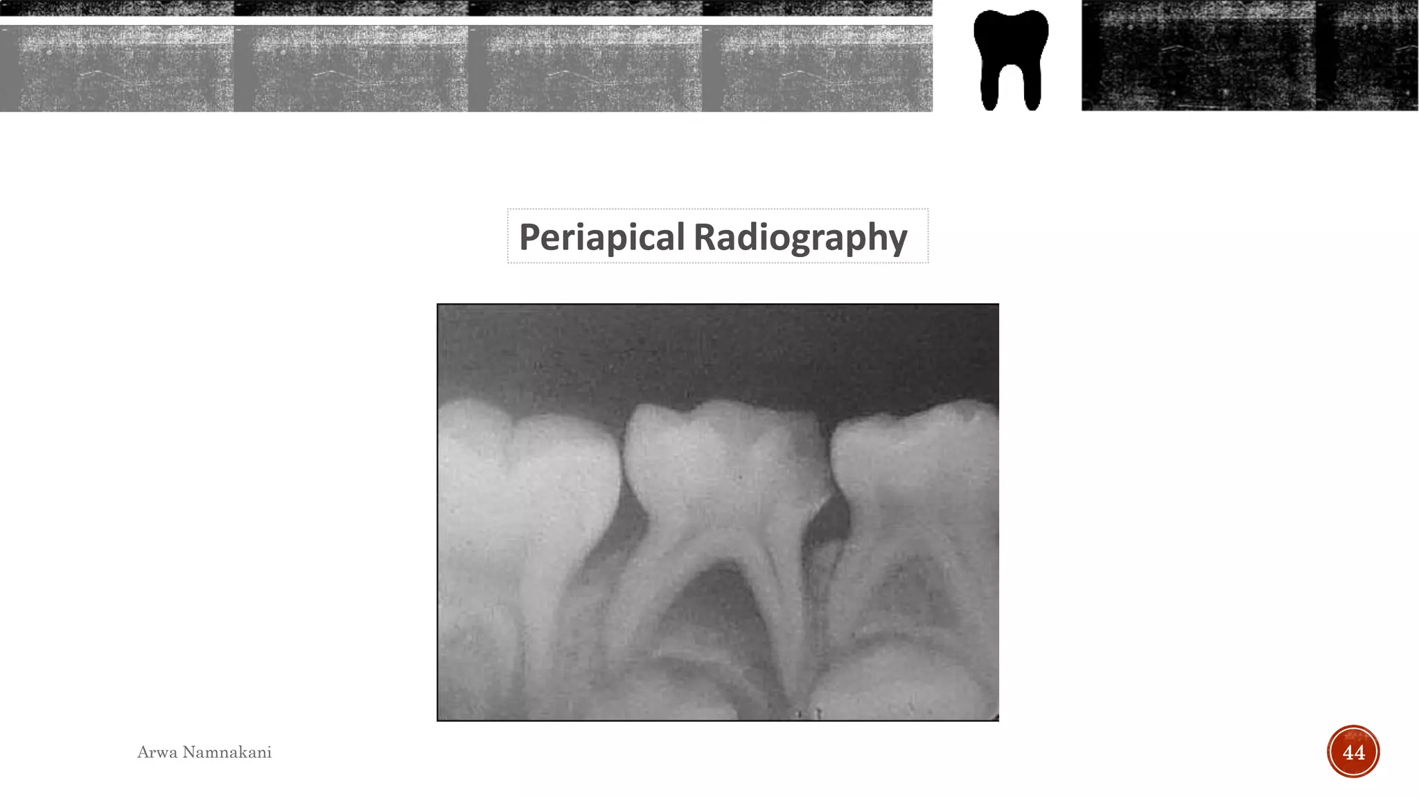 Radiograph Techniques in Pediatric Dentistry | PPTX