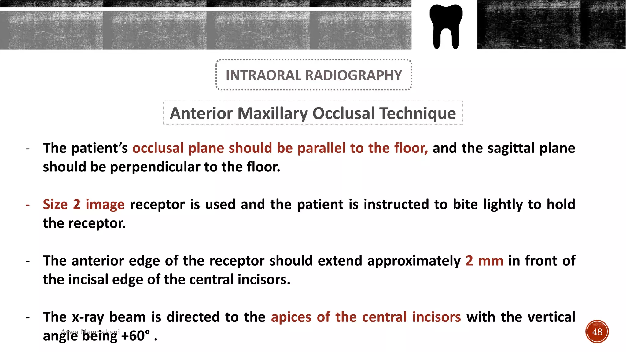 Radiograph Techniques in Pediatric Dentistry | PPTX
