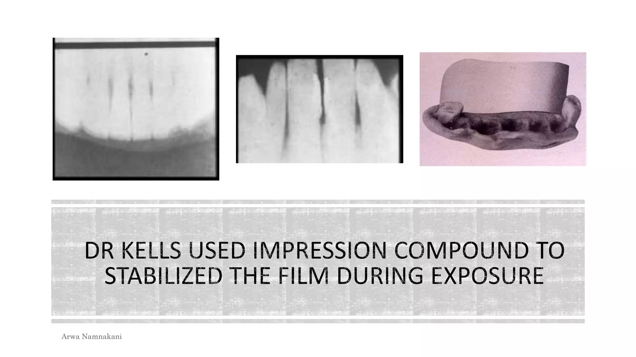Radiograph Techniques in Pediatric Dentistry | PPTX
