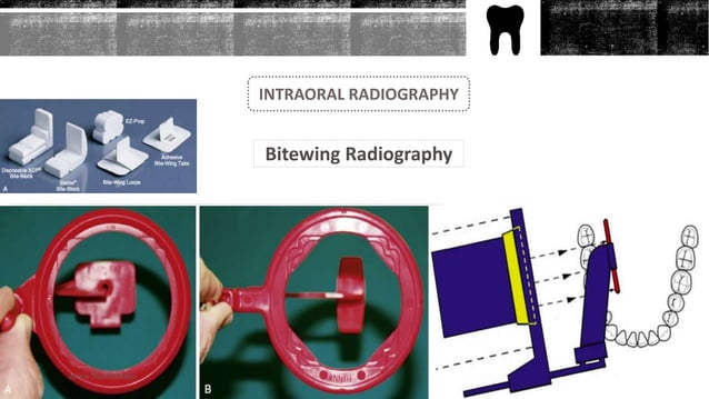 Radiograph Techniques in Pediatric Dentistry | PPTX