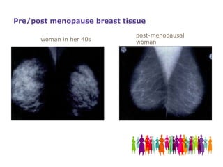 BreastScreen Victoria overview for Radiographers | PPT
