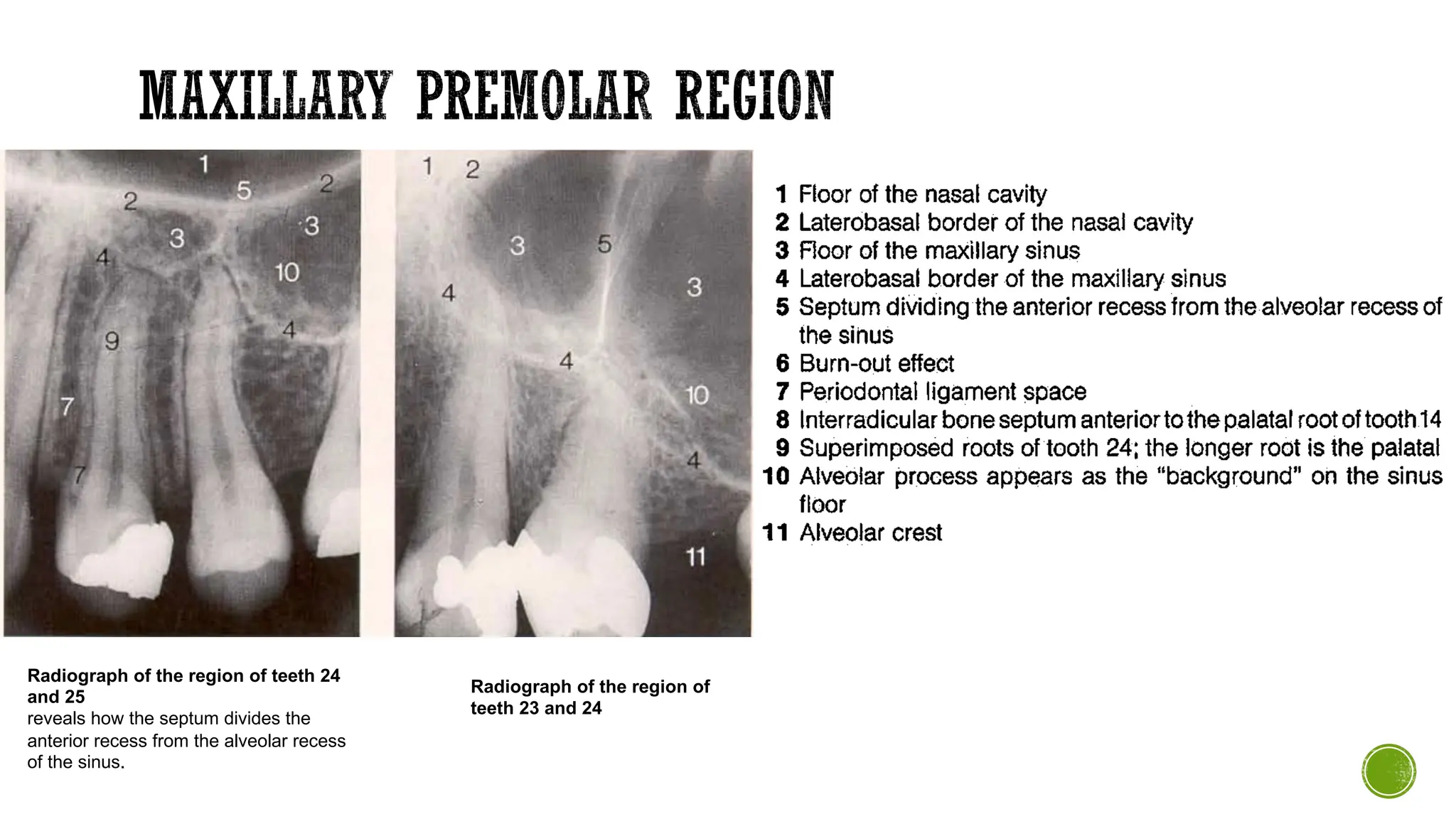 Radiographic-Anatomy-Periapical-Occlusal-Radiograph (1).pdf