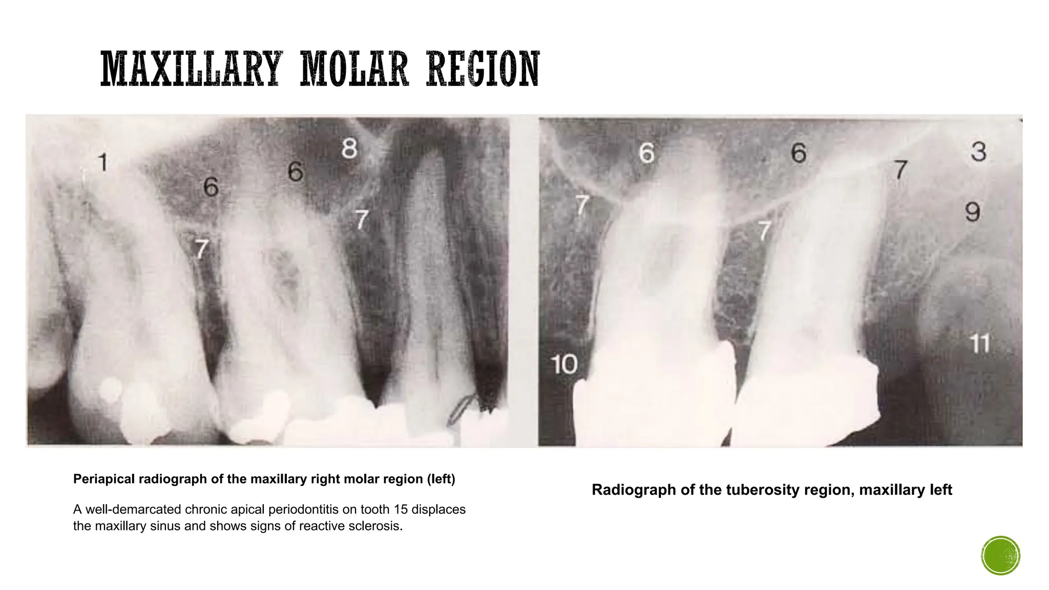 Radiographic-Anatomy-Periapical-Occlusal-Radiograph (1).pdf