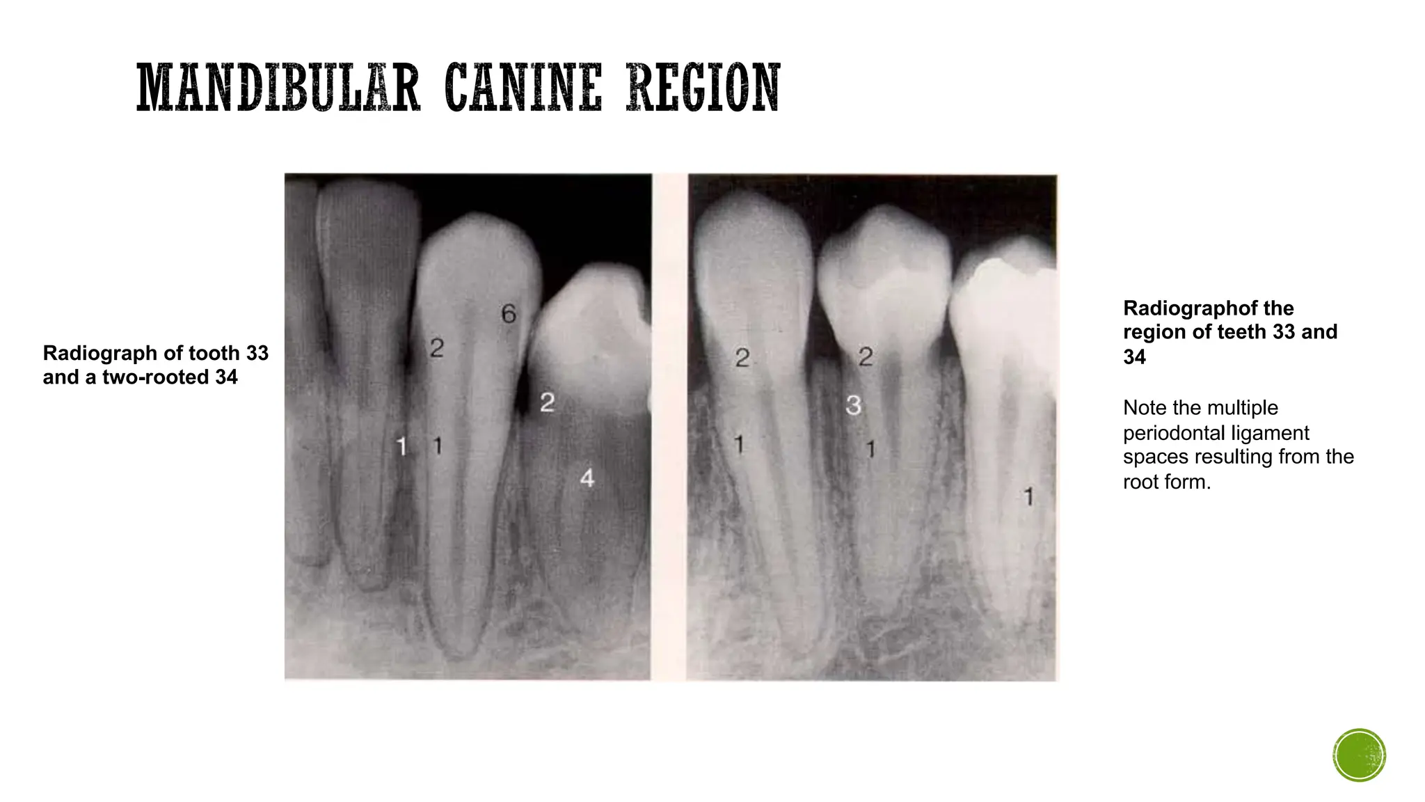 Radiographic-Anatomy-Periapical-Occlusal-Radiograph (1).pdf