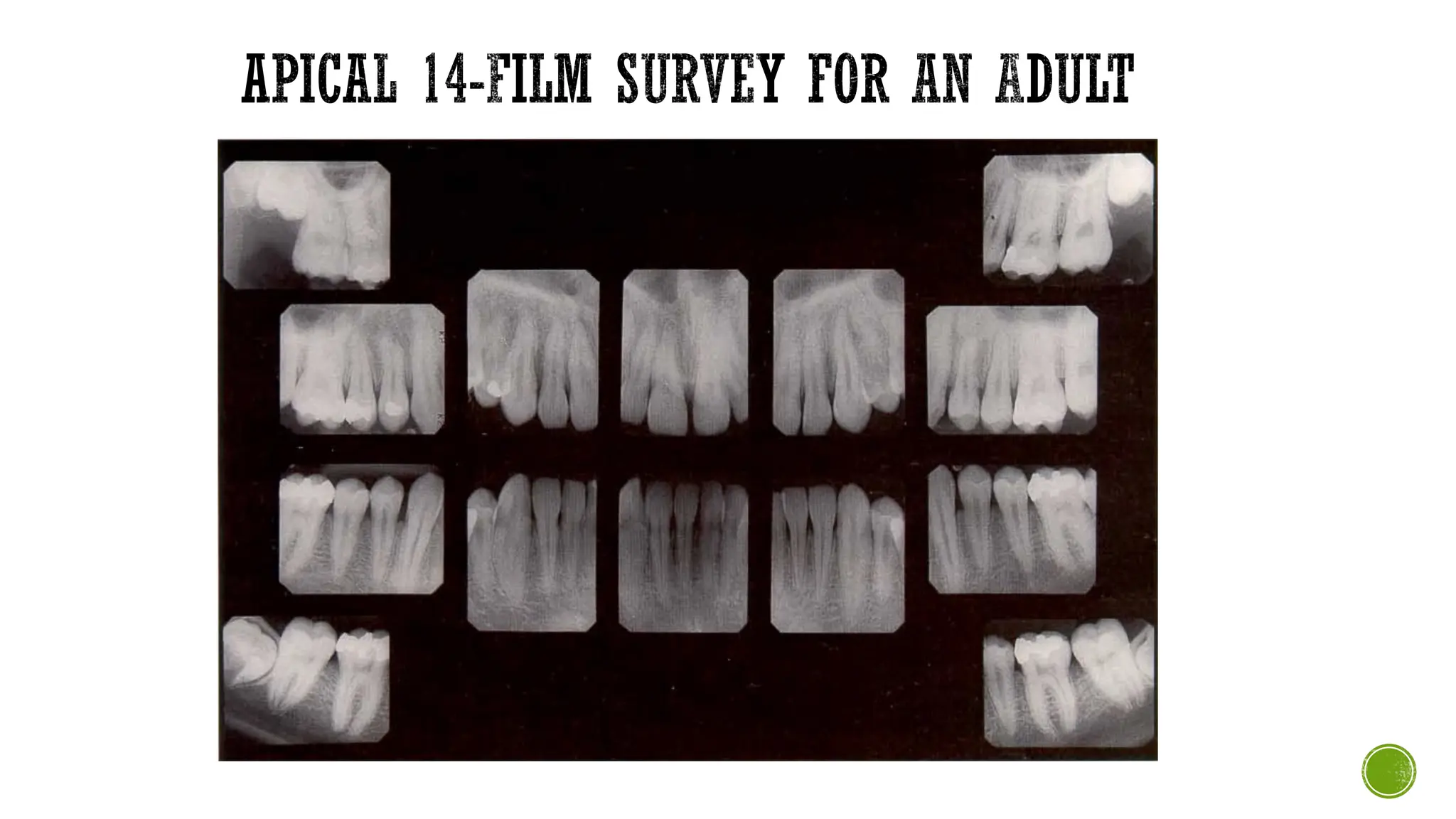 Radiographic-Anatomy-Periapical-Occlusal-Radiograph (1).pdf