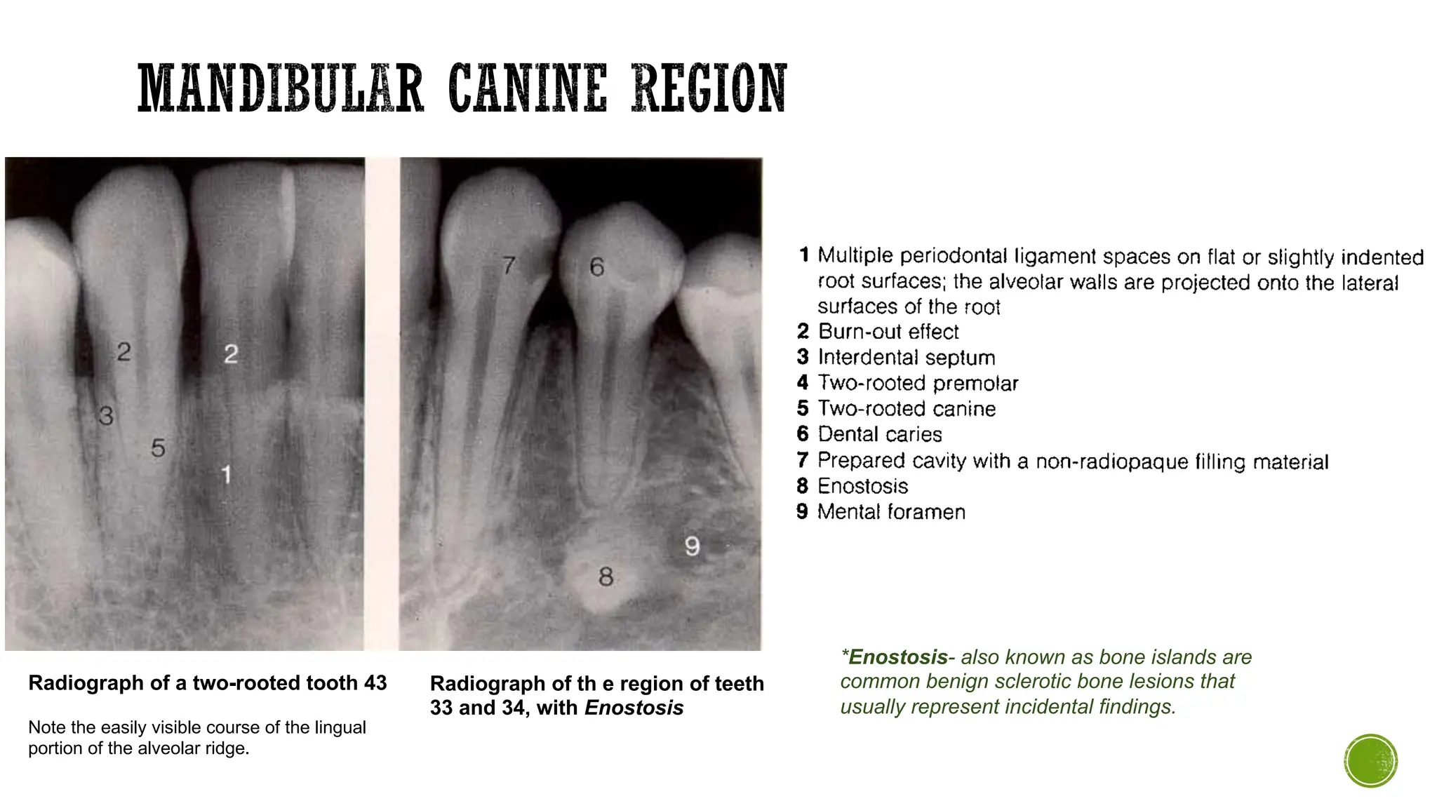 Radiographic-Anatomy-Periapical-Occlusal-Radiograph (1).pdf