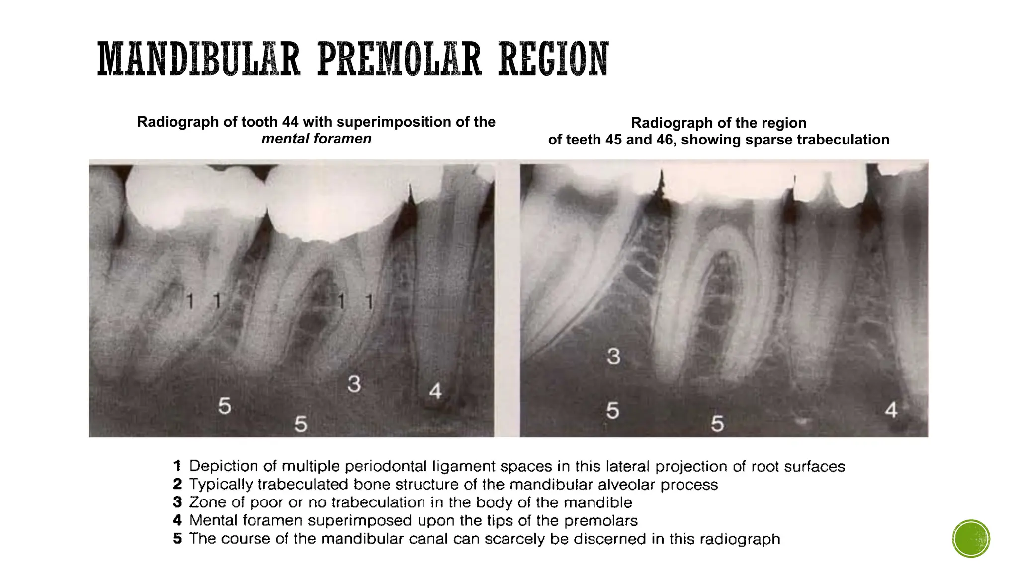 Radiographic-Anatomy-Periapical-Occlusal-Radiograph (1).pdf