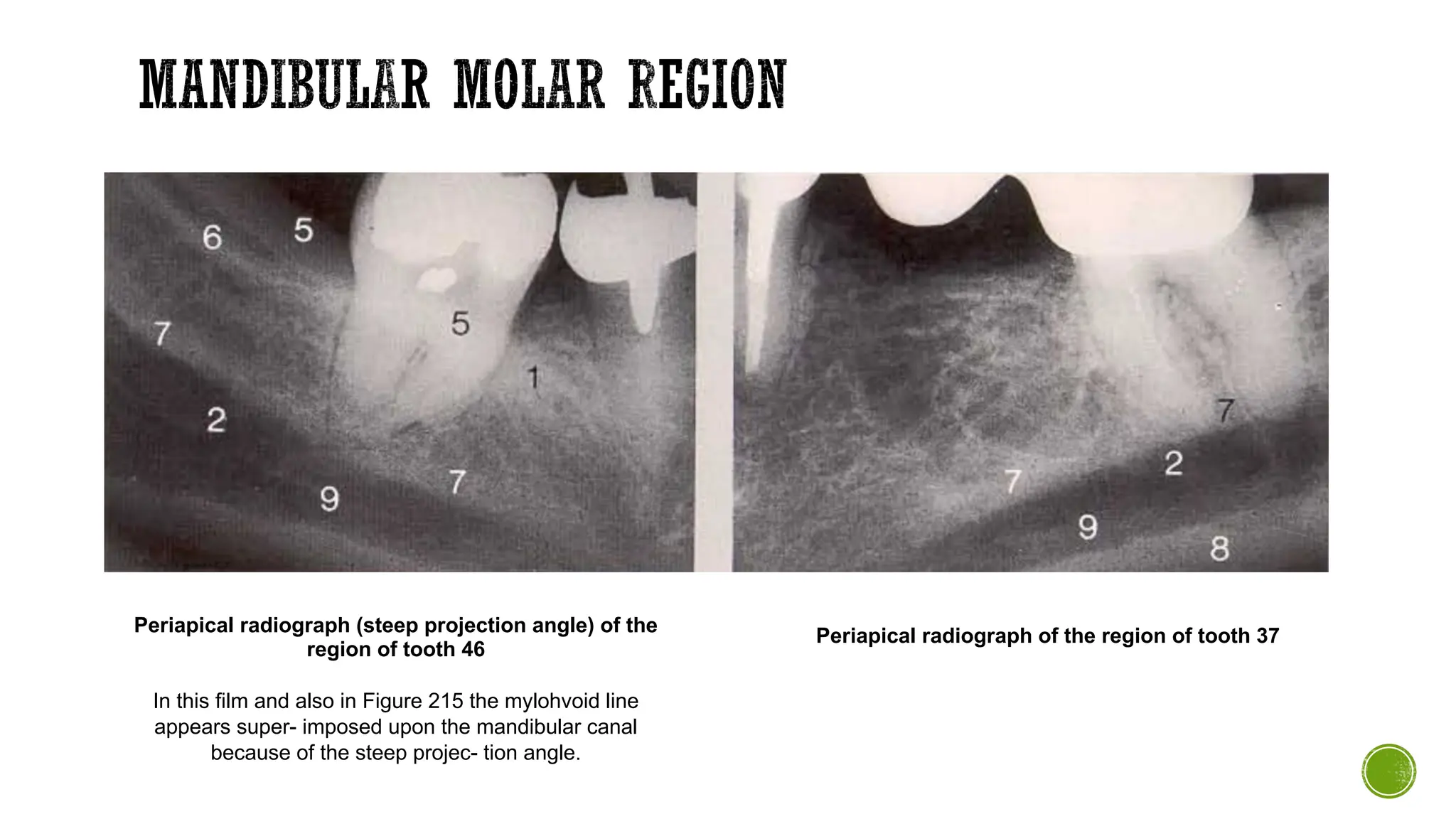 Radiographic-Anatomy-Periapical-Occlusal-Radiograph (1).pdf