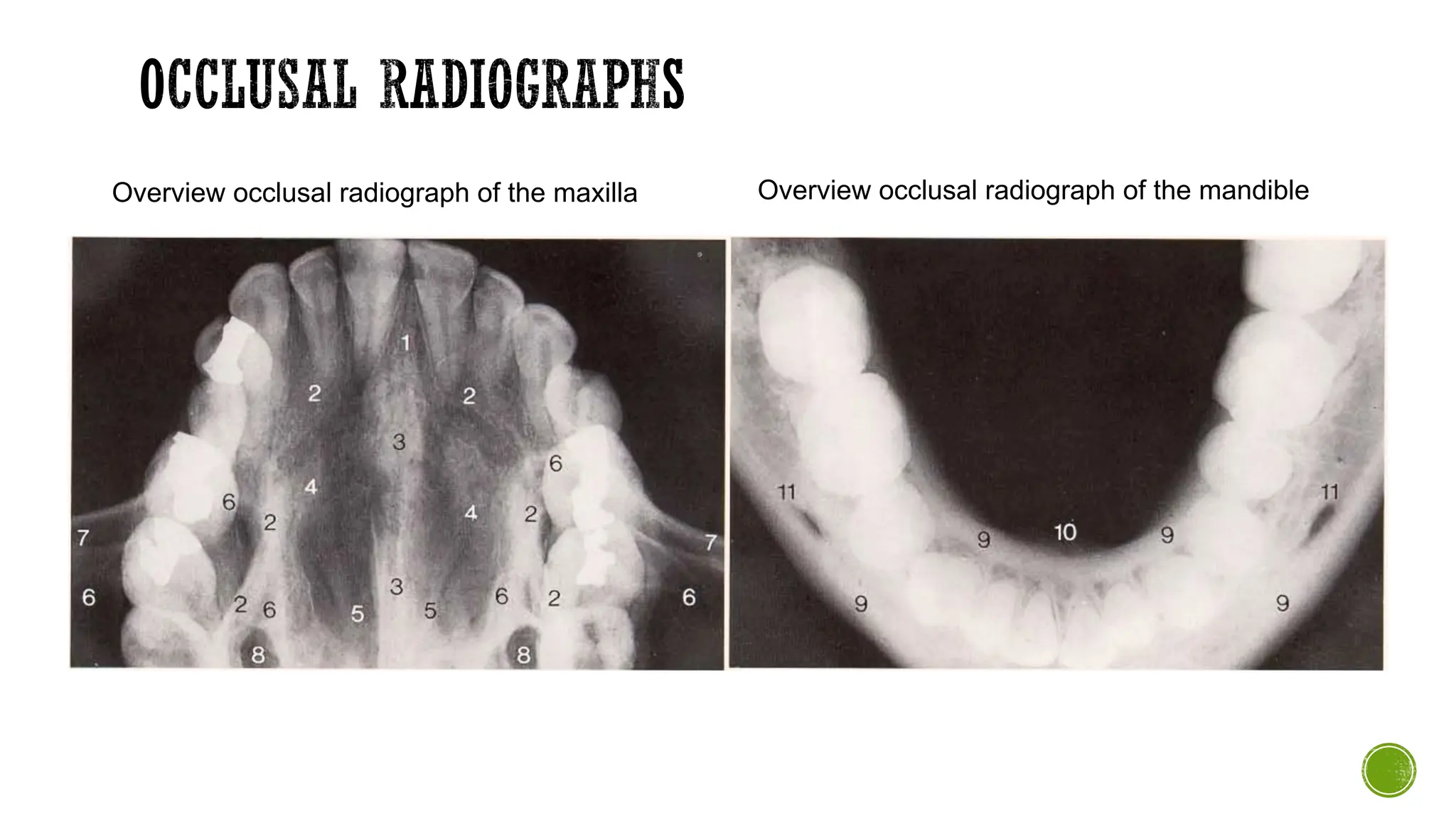 Radiographic-Anatomy-Periapical-Occlusal-Radiograph (1).pdf