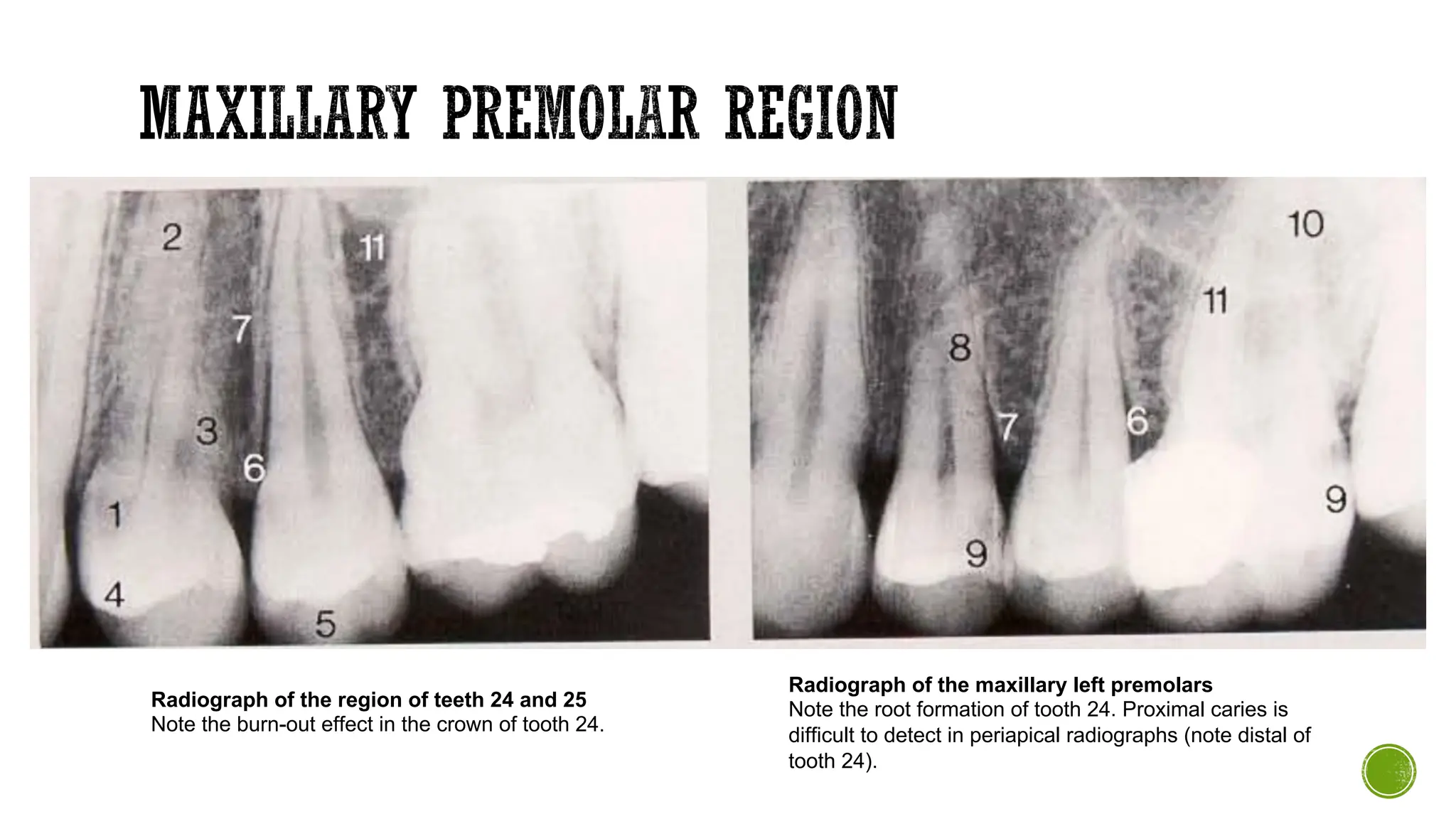 Radiographic-Anatomy-Periapical-Occlusal-Radiograph (1).pdf