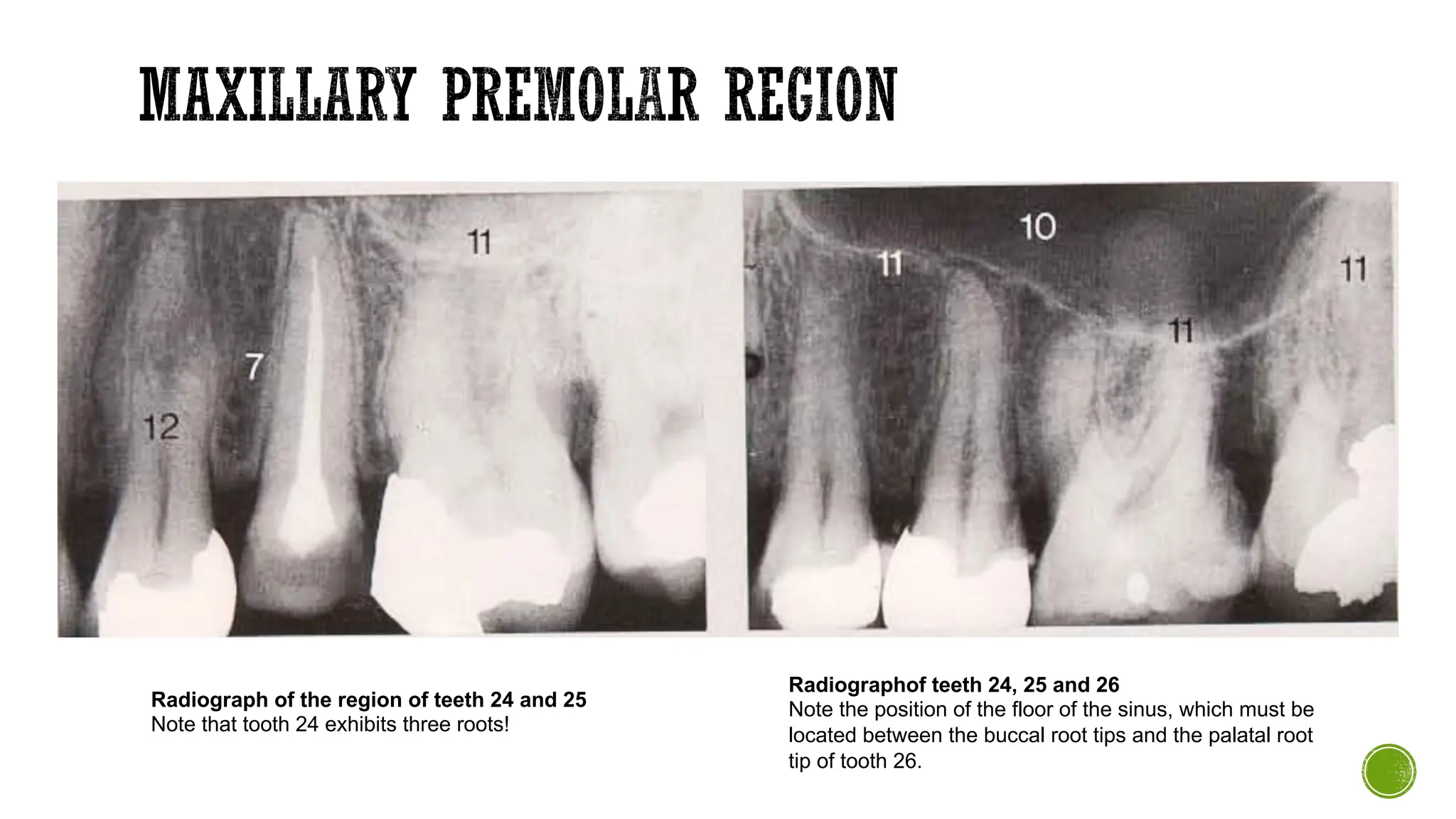 Radiographic-Anatomy-Periapical-Occlusal-Radiograph (1).pdf