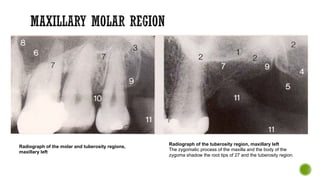 Radiographic-Anatomy-Periapical-Occlusal-Radiograph (1).pdf