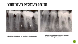 Radiographic-Anatomy-Periapical-Occlusal-Radiograph (1).pdf