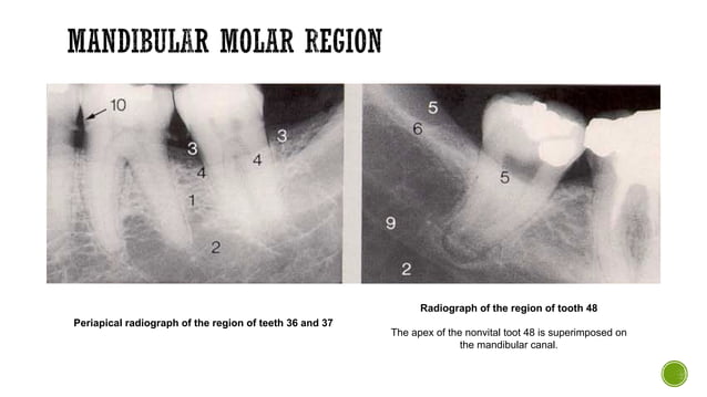 Radiographic-Anatomy-Periapical-Occlusal-Radiograph (1).pdf