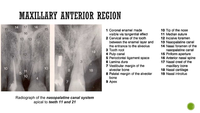 Radiographic-Anatomy-Periapical-Occlusal-Radiograph (1).pdf