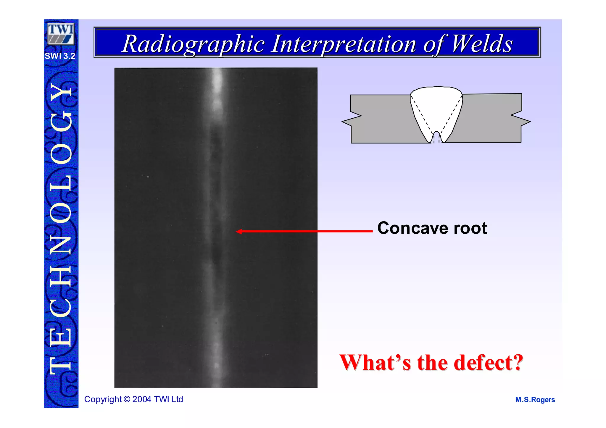 radiographic-interpretation.pdf