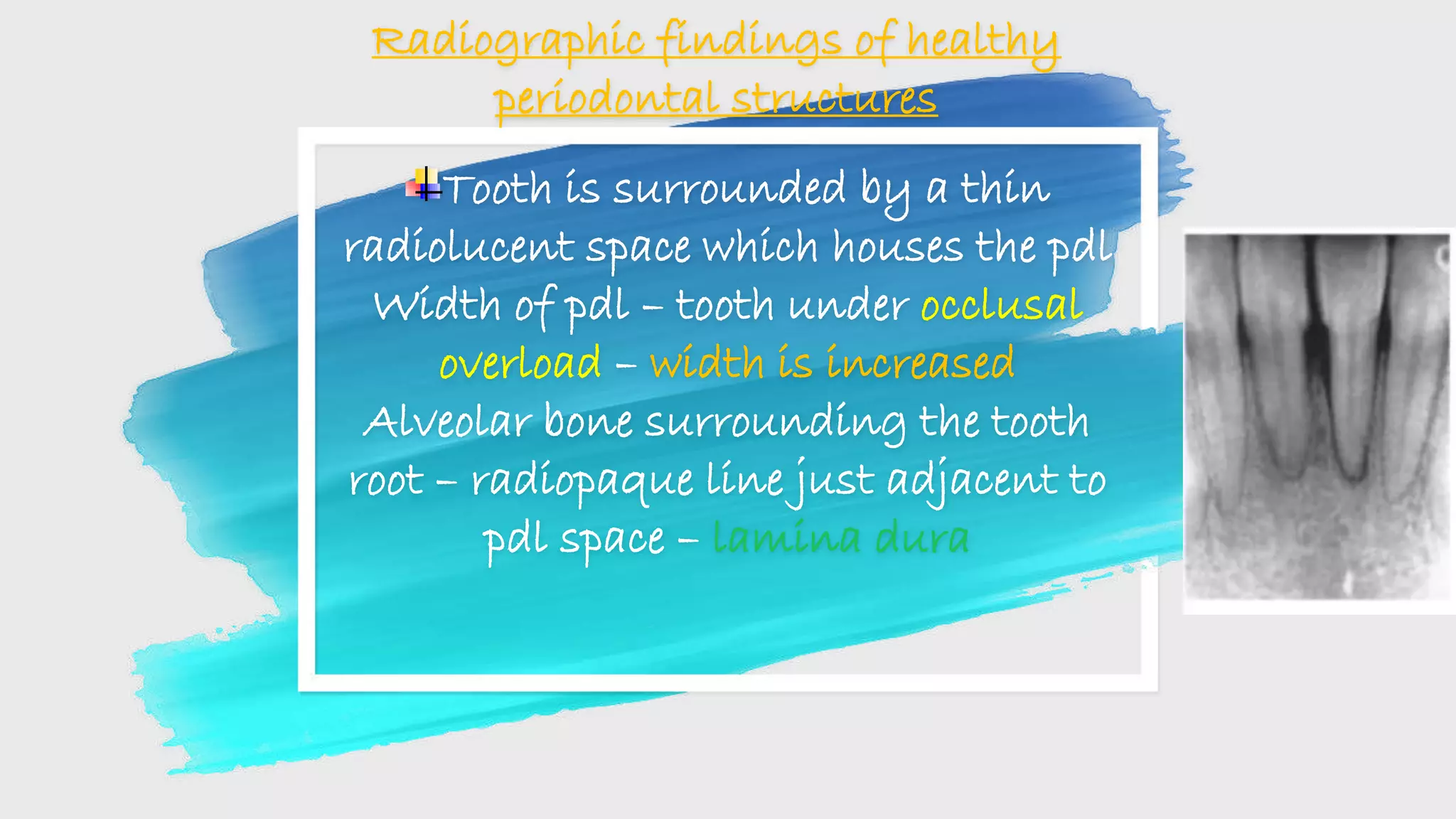 Radiographic aids in Periodontal Diagnosis | PPTX