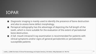 Radiographic aids used in Periodontal Diagnosis | PPTX