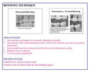 Radiographic aids in diagnosis of periodontal disease seminar.ppt