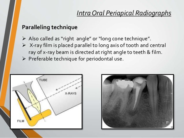 Radiographic aids in dx of periodontol ds