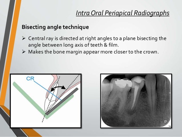 Radiographic aids in dx of periodontol ds