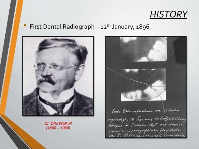 Radiographic aids in dx of periodontol ds