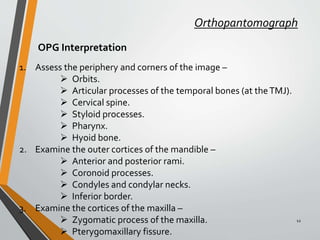 Radiographic aids in dx of periodontol ds part b | PPTX