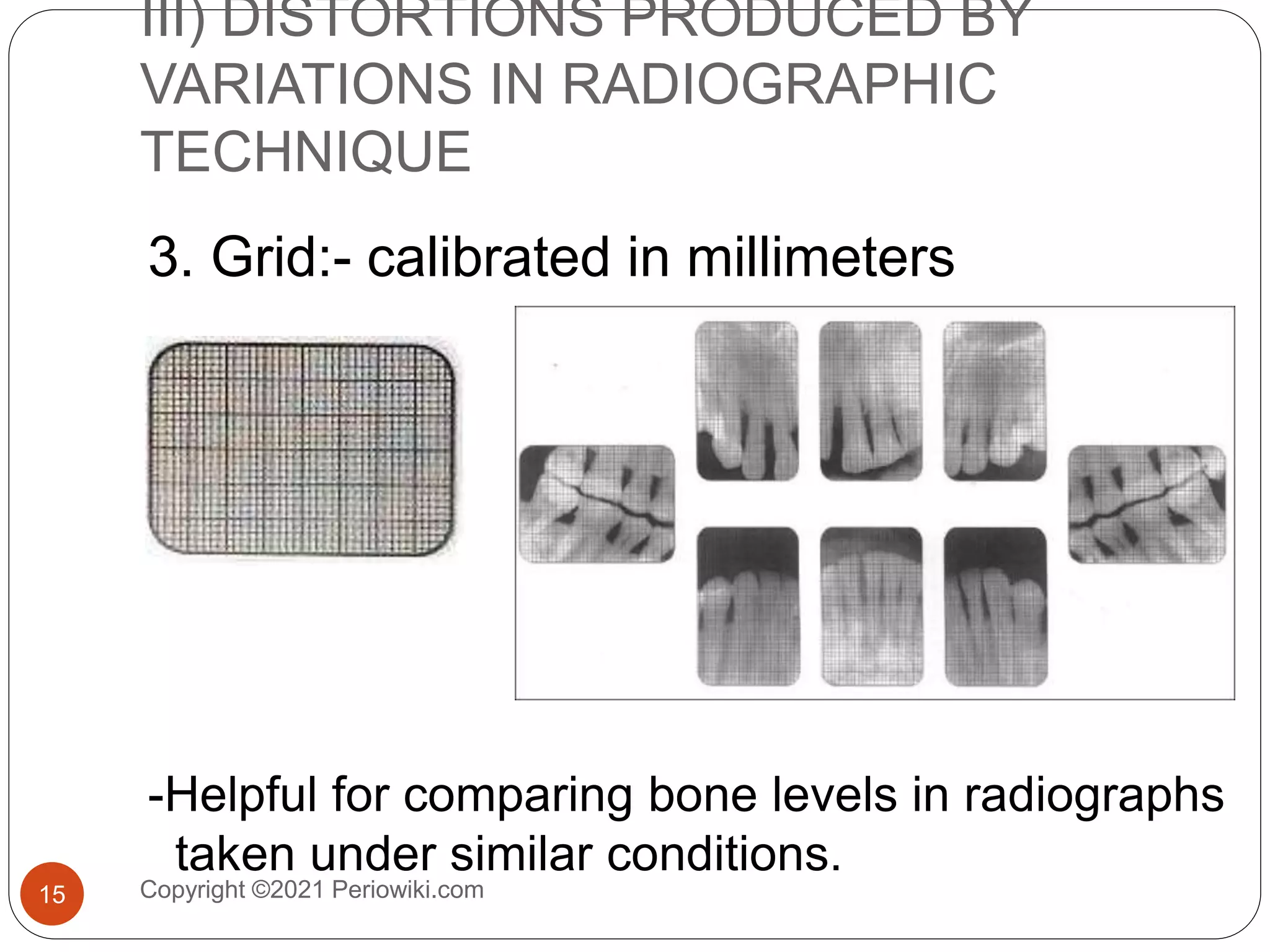 Radiographic aids in periodontal disease diagnosis part I | PPTX