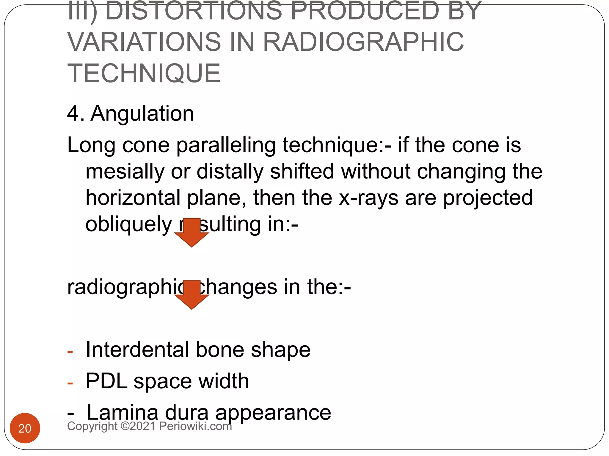 Radiographic aids in periodontal disease diagnosis part I | PPTX