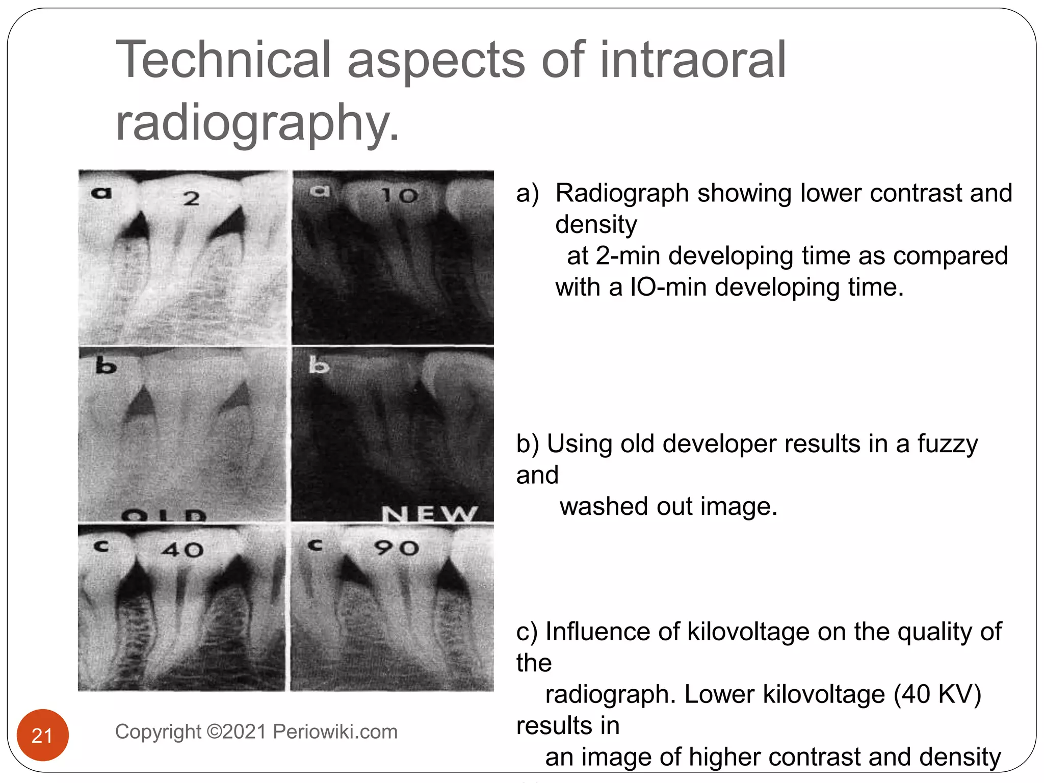Radiographic aids in periodontal disease diagnosis part I | PPTX