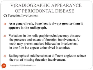 Radiographic aids in periodontal disease diagnosis part I | PPTX