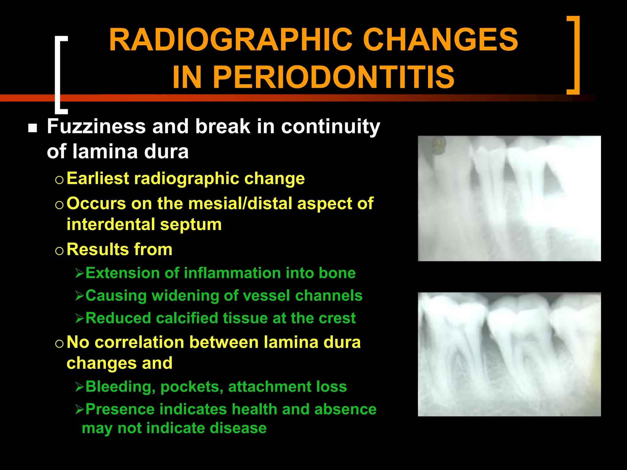 radiographic aids in the diagnosis of periodontal disease.ppt