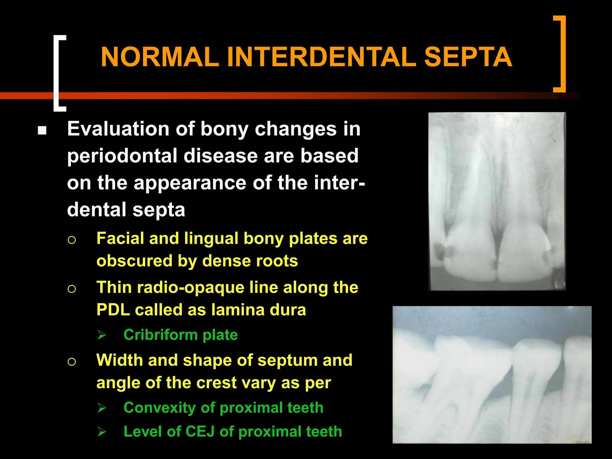 radiographic aids in the diagnosis of periodontal disease.ppt