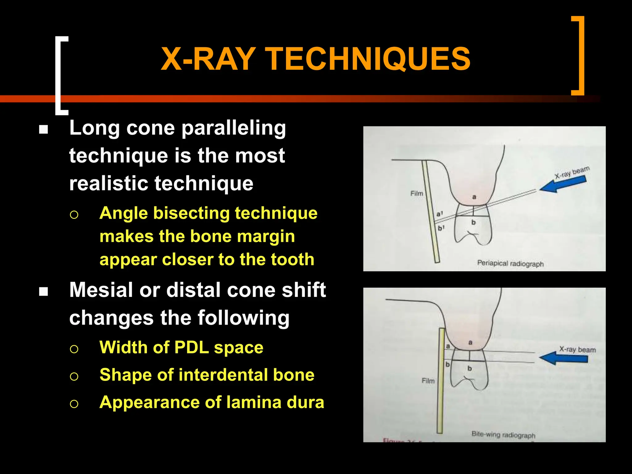 radiographic aids in the diagnosis of periodontal disease.ppt