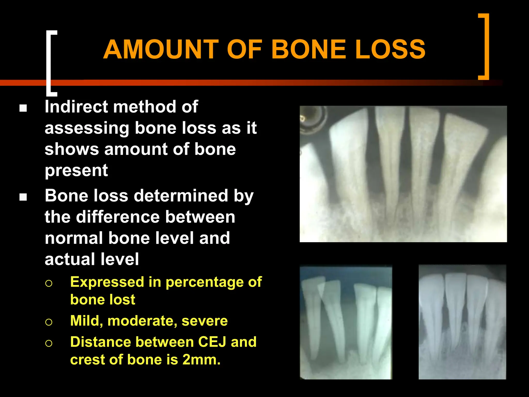 radiographic aids in the diagnosis of periodontal disease.ppt