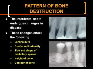 radiographic aids in the diagnosis of periodontal disease.ppt