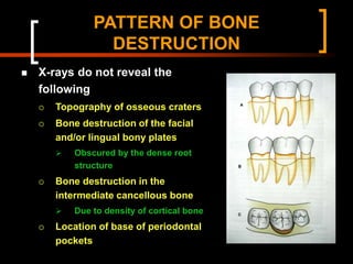 radiographic aids in the diagnosis of periodontal disease.ppt